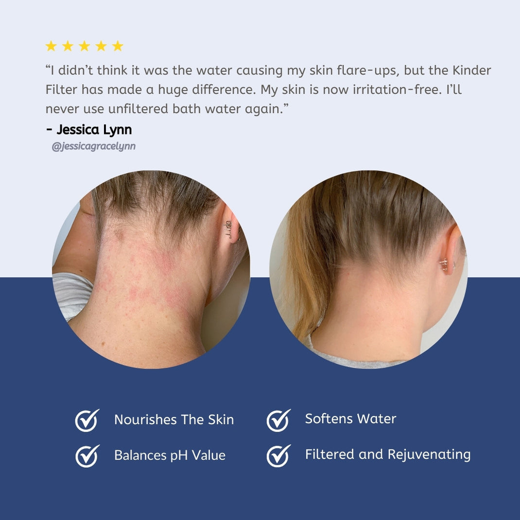 Skincare Bath Filter by Kinder Filter