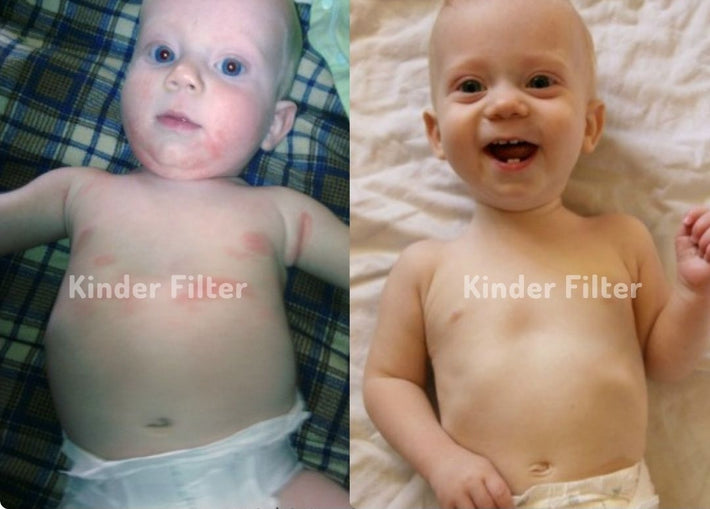 Skincare Bath Filter by Kinder Filter