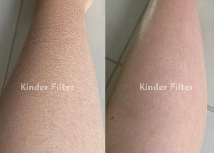 Skincare Bath Filter by Kinder Filter